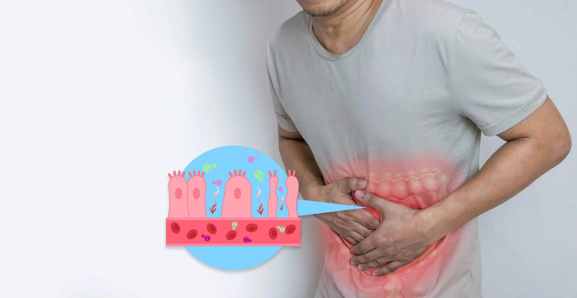 The Role of Postbiotics in Leaky Gut Syndrome - ADVAGEN Postbio | Gut ...